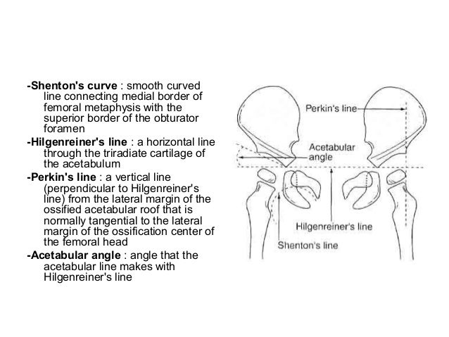 Diagnostic Imaging of Pediatric Hip Lesions