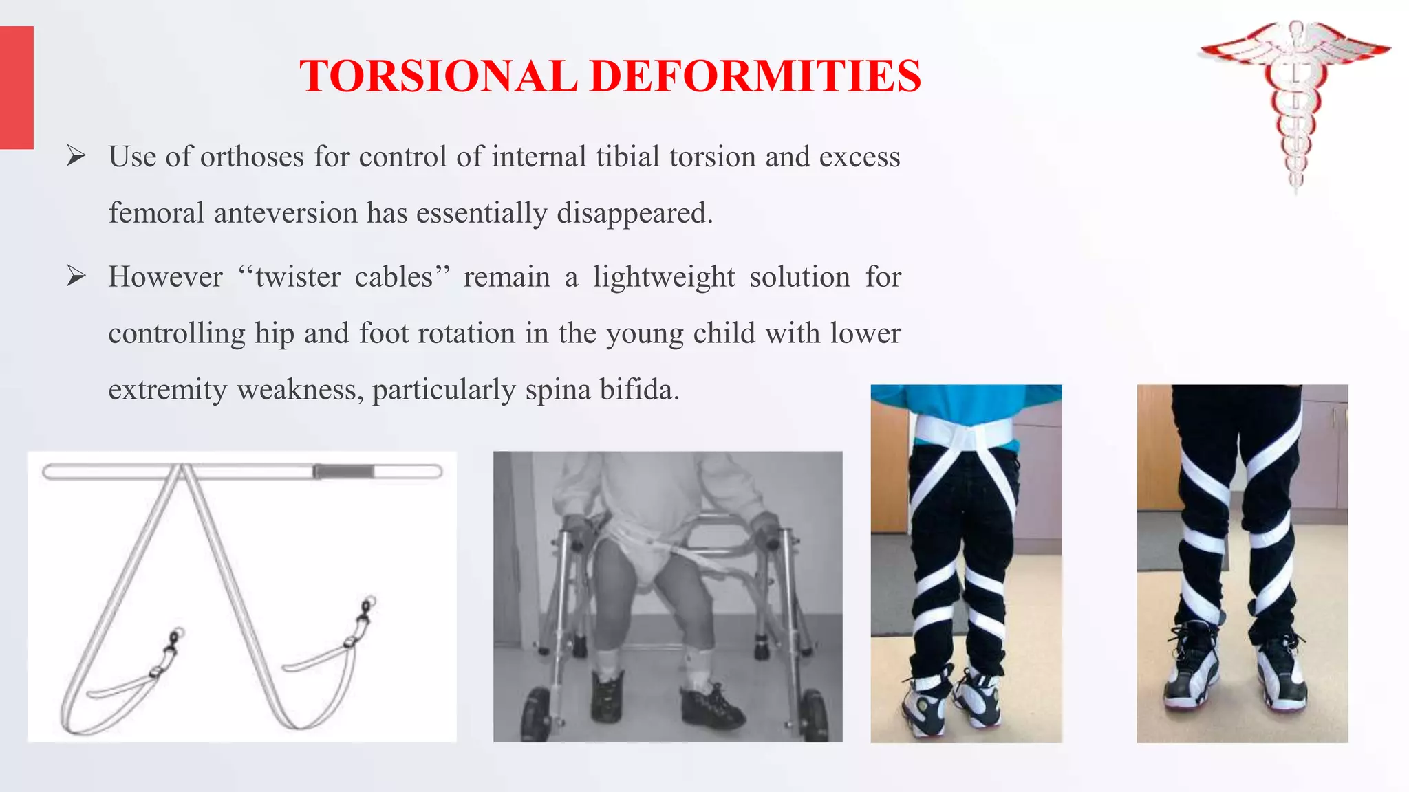Pediatric hip orthoses.pptx