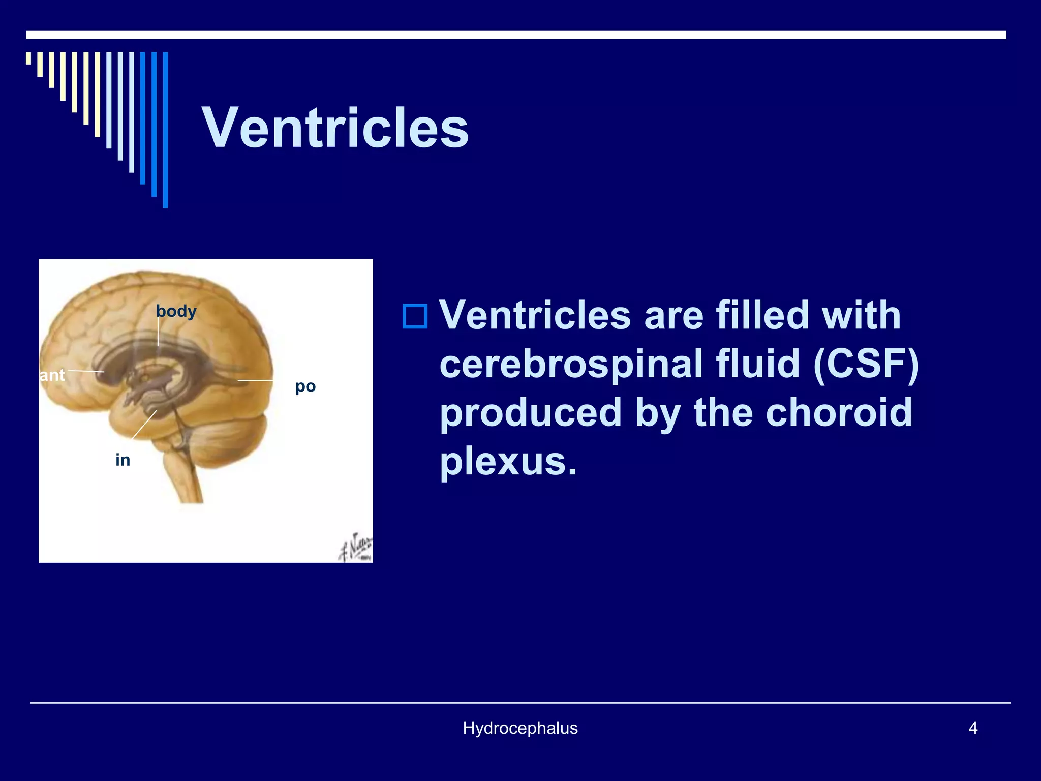 Hydrocephalus | PPT