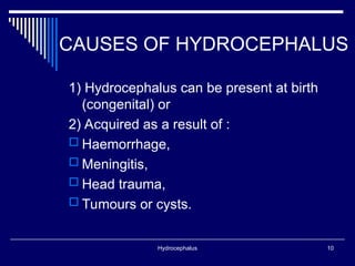 Pediatric Hydrocephalus Treatment and Diagnosis | PPT