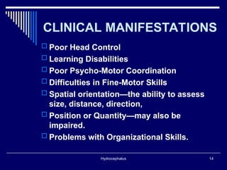 Pediatric Hydrocephalus Treatment and Diagnosis | PPT