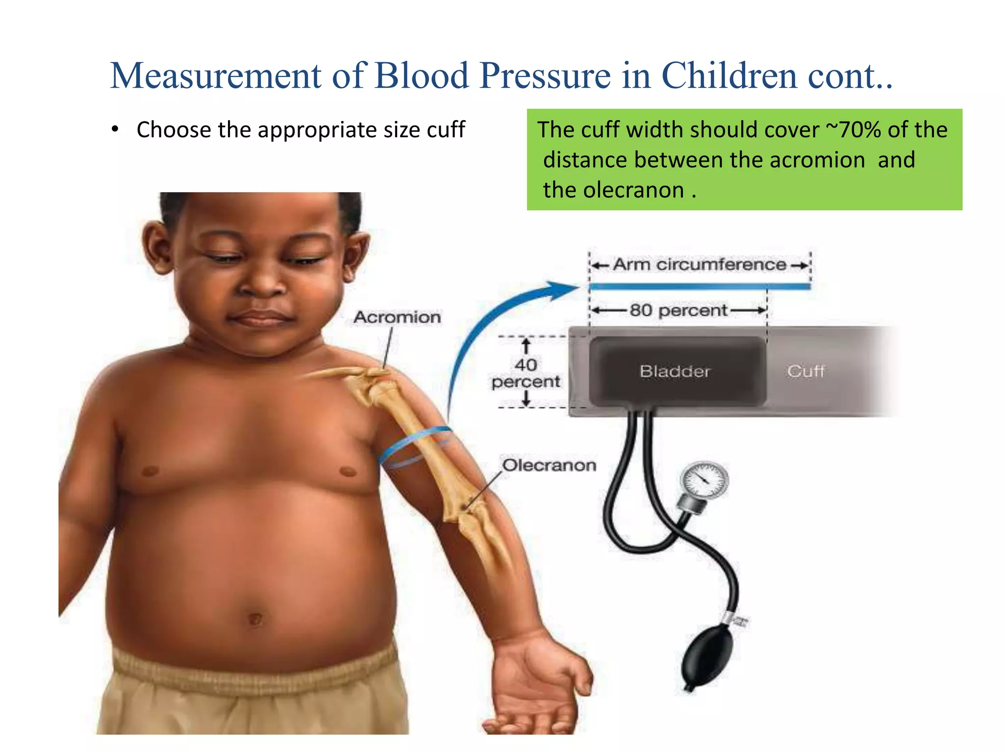 Pediatric hypertension | PPTX