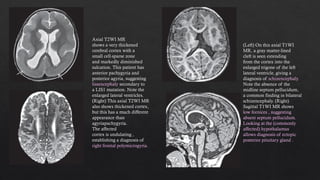 Pediatric imaging techniques and normal variants. | PPTX