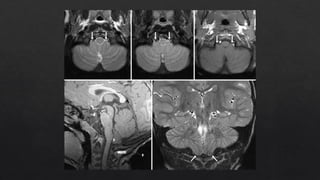 Pediatric imaging techniques and normal variants. | PPTX