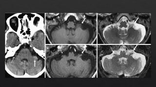 Pediatric imaging techniques and normal variants. | PPTX