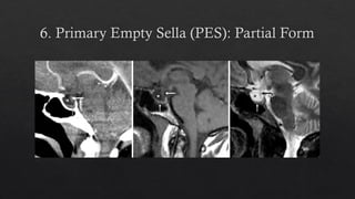 Pediatric imaging techniques and normal variants. | PPTX
