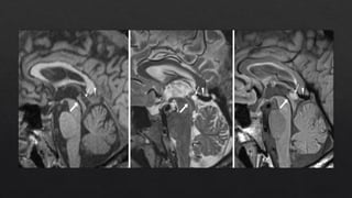 Pediatric imaging techniques and normal variants. | PPTX