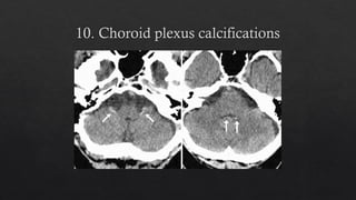 Pediatric imaging techniques and normal variants. | PPTX