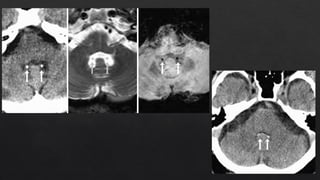 Pediatric imaging techniques and normal variants. | PPTX