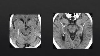 Pediatric imaging techniques and normal variants. | PPTX