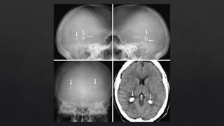 Pediatric imaging techniques and normal variants. | PPTX