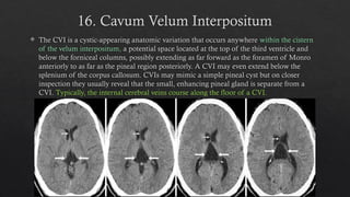 Pediatric imaging techniques and normal variants. | PPTX