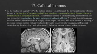 Pediatric imaging techniques and normal variants. | PPTX