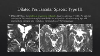 Pediatric imaging techniques and normal variants. | PPTX
