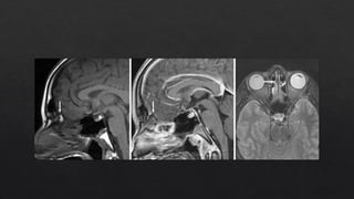 Pediatric imaging techniques and normal variants. | PPTX