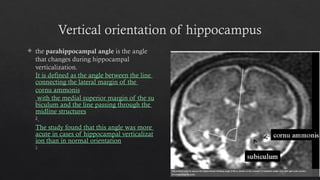 Pediatric imaging techniques and normal variants. | PPTX