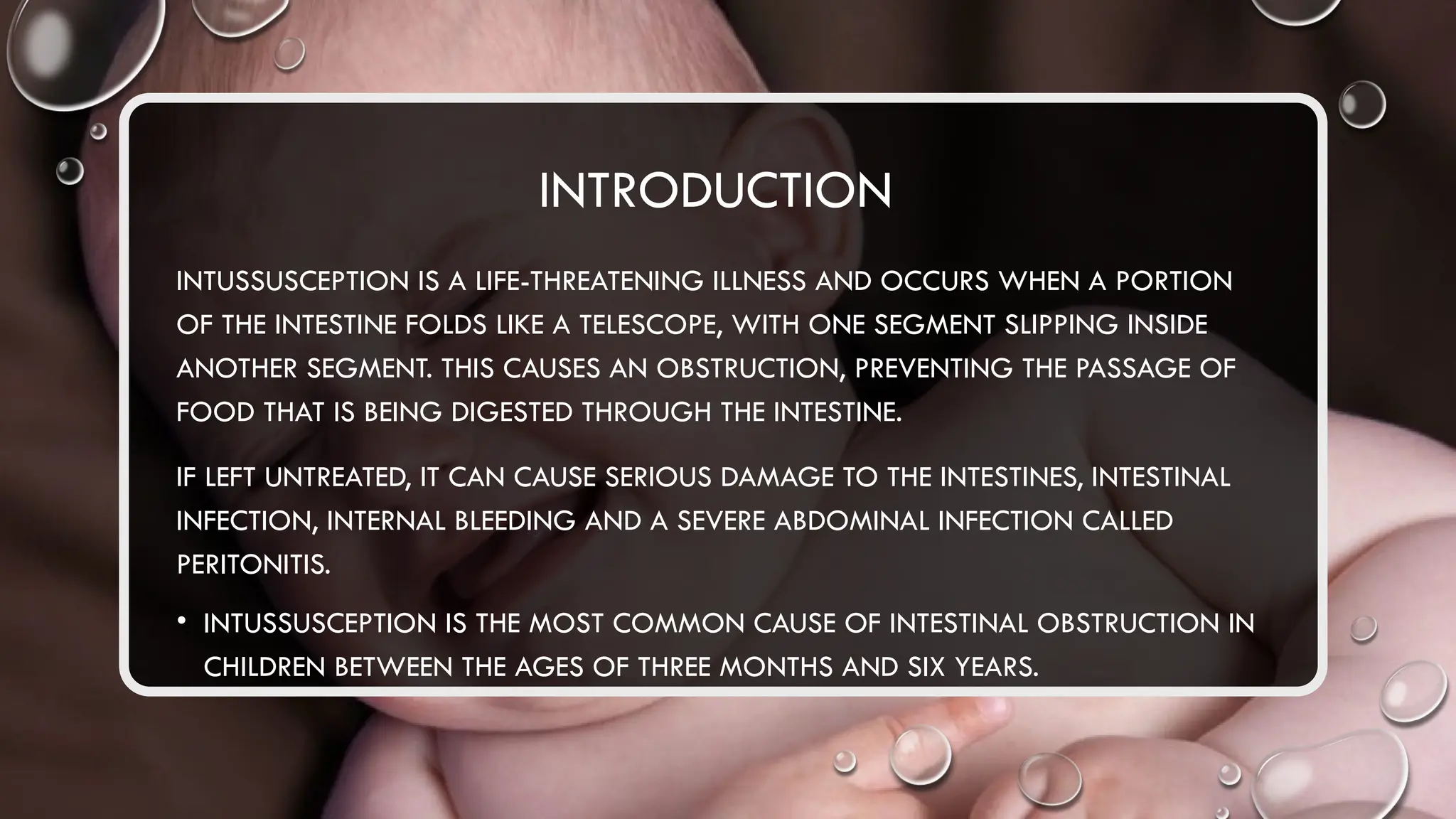 case of pediatric intestinal intussception.pptx