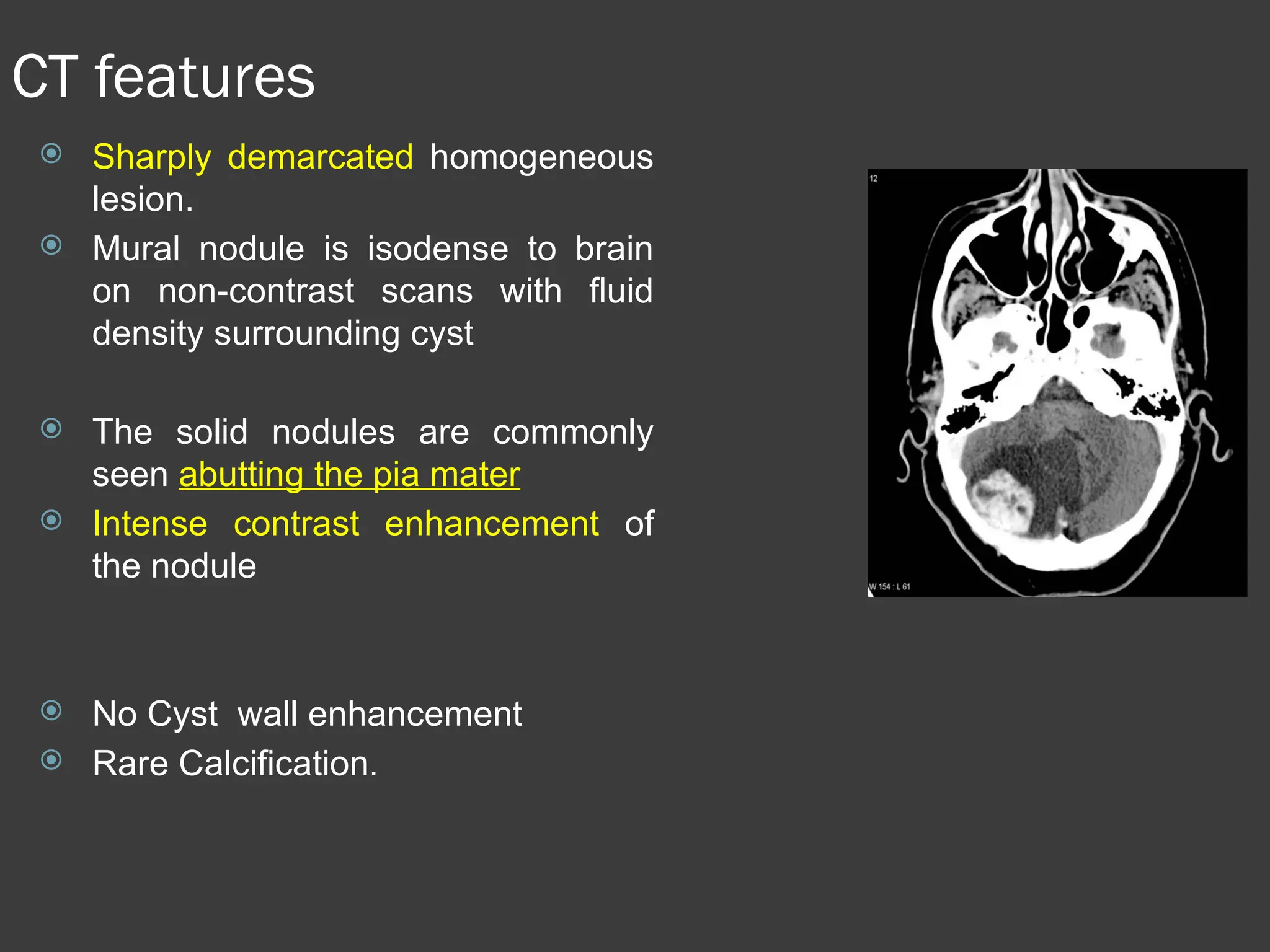 pediatric intracranial masses 7-10-2024.ppsx