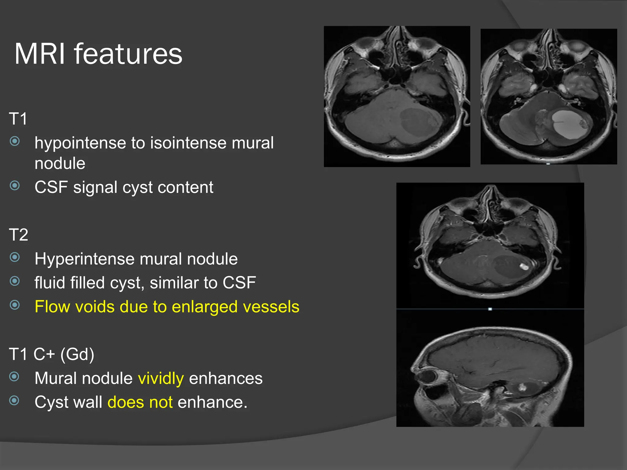 pediatric intracranial masses 7-10-2024.ppsx