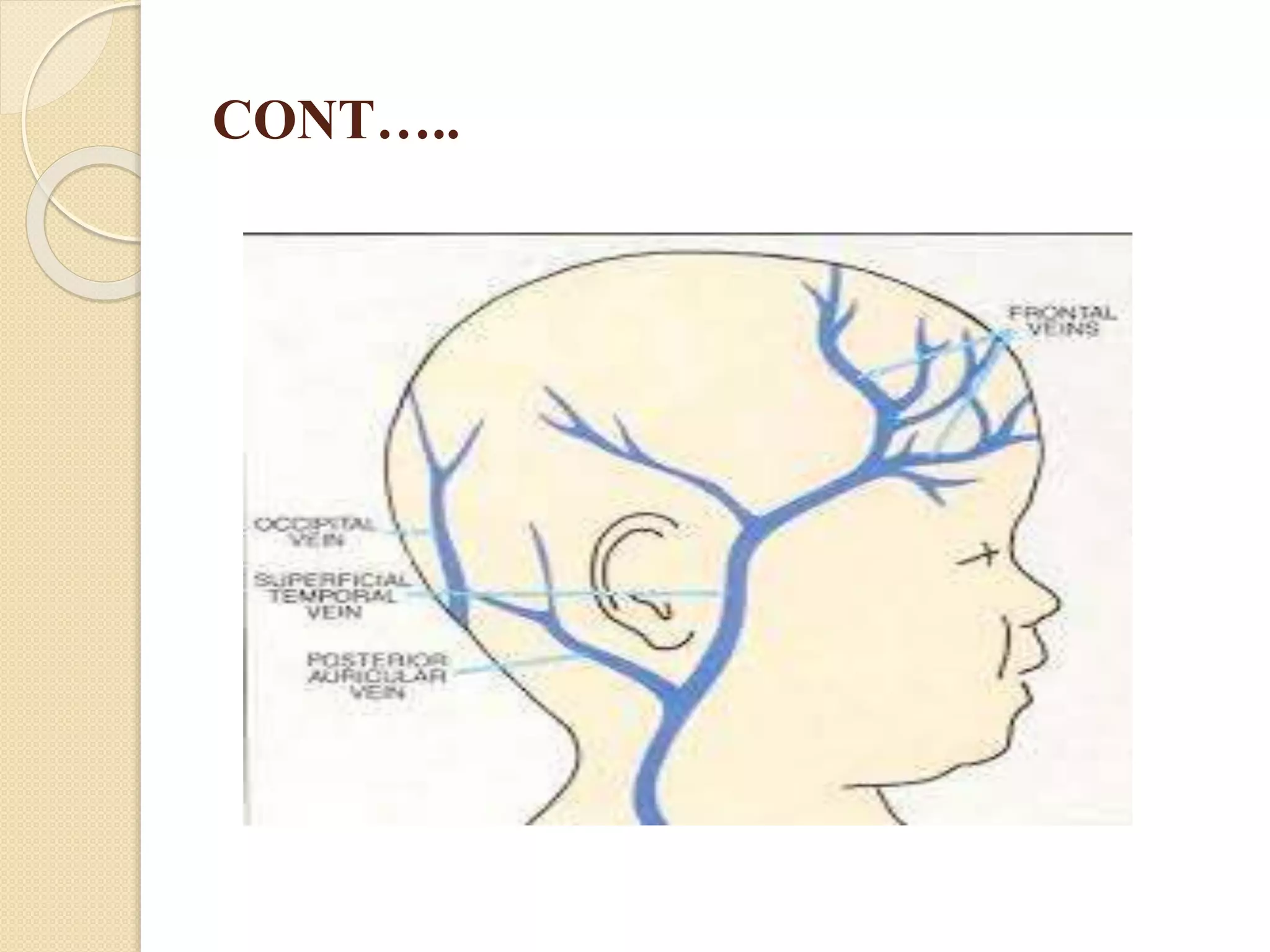 Pediatric intravenous cannulation | PPTX