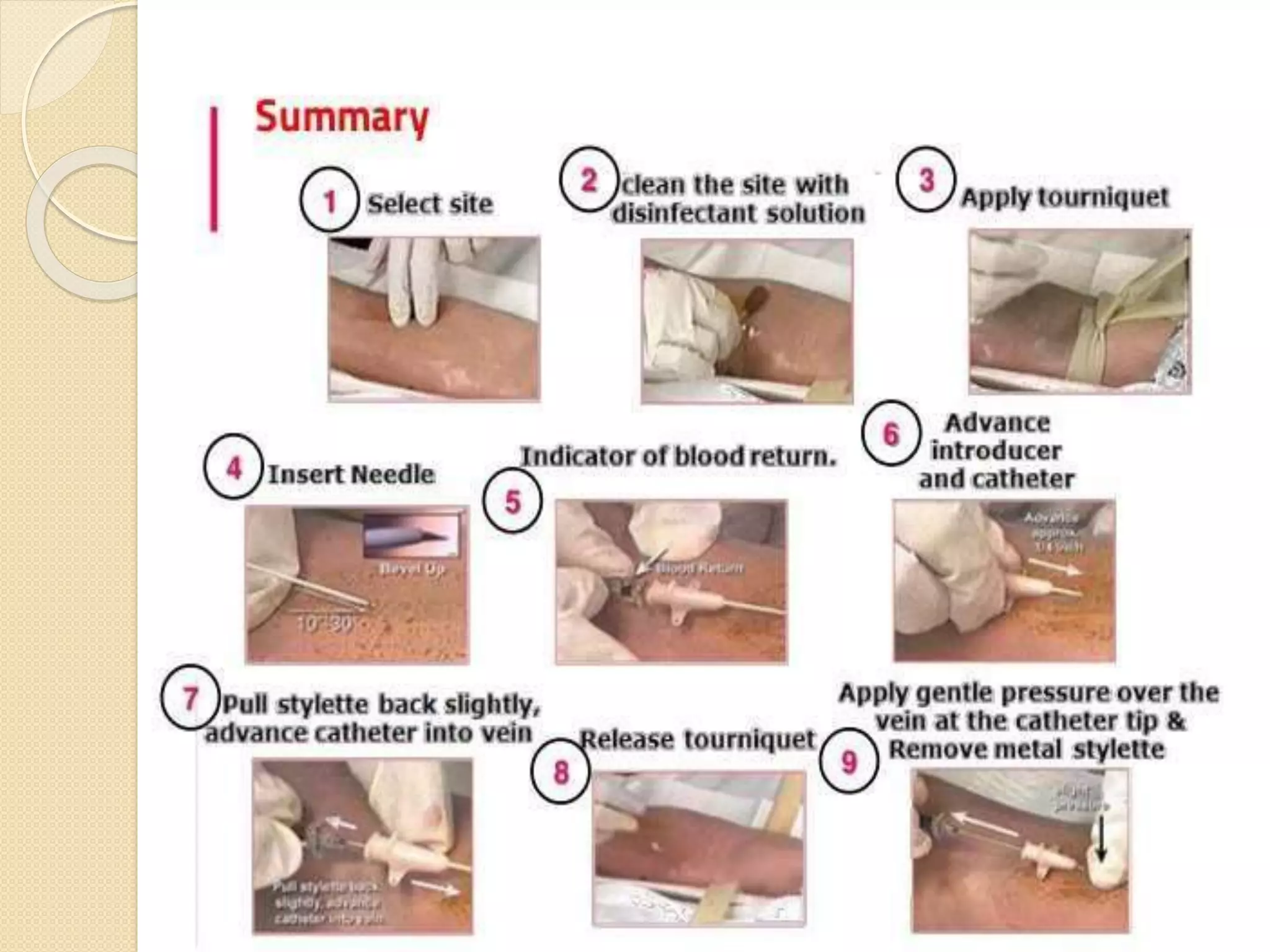 Pediatric intravenous cannulation | PPTX