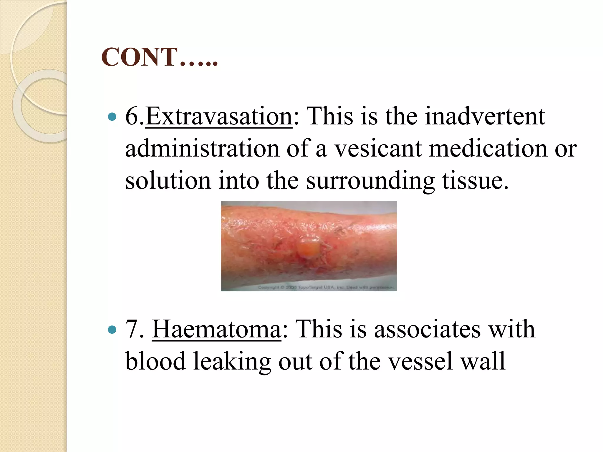 Pediatric intravenous cannulation | PPTX