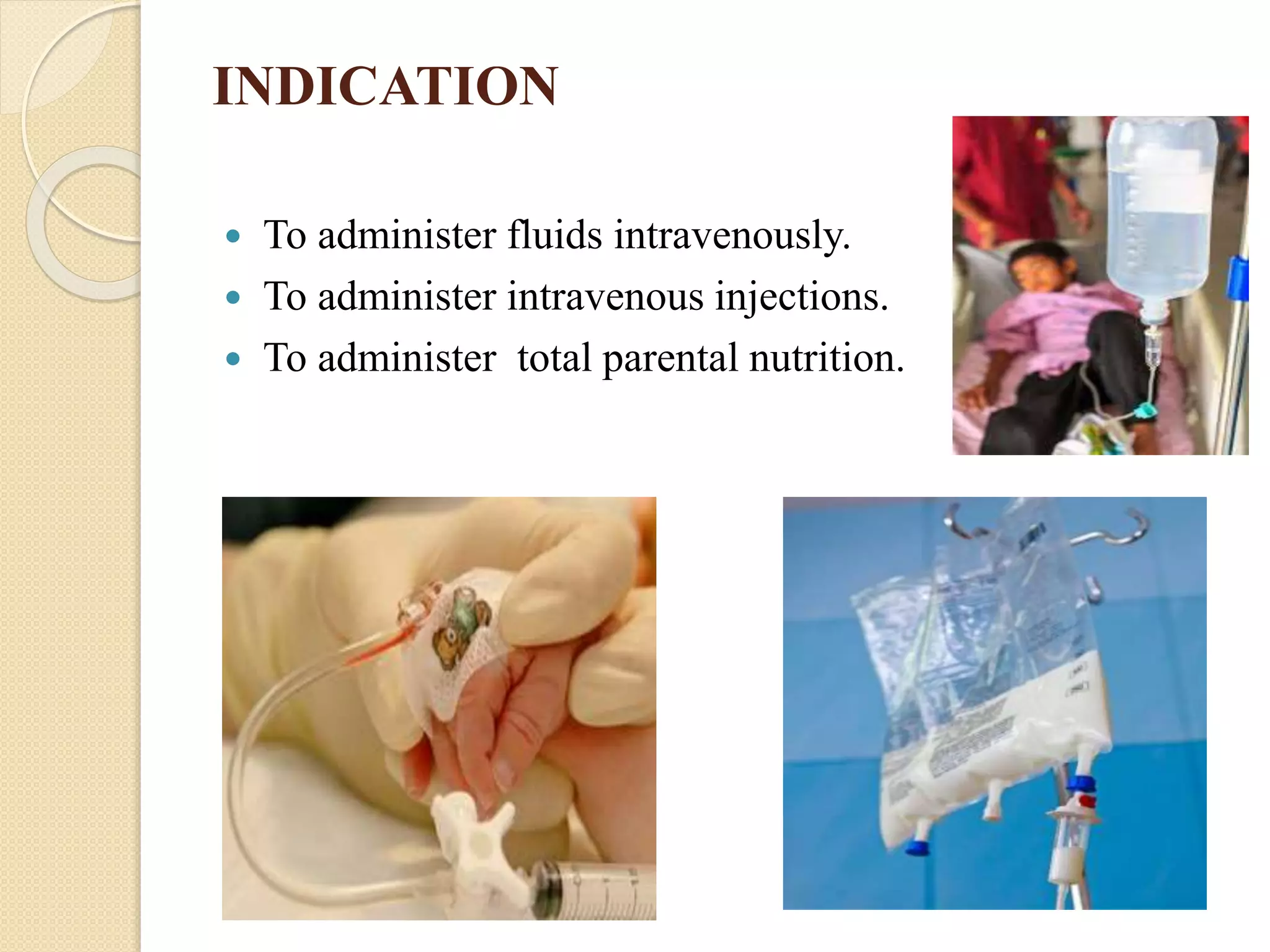 Pediatric intravenous cannulation | PPTX
