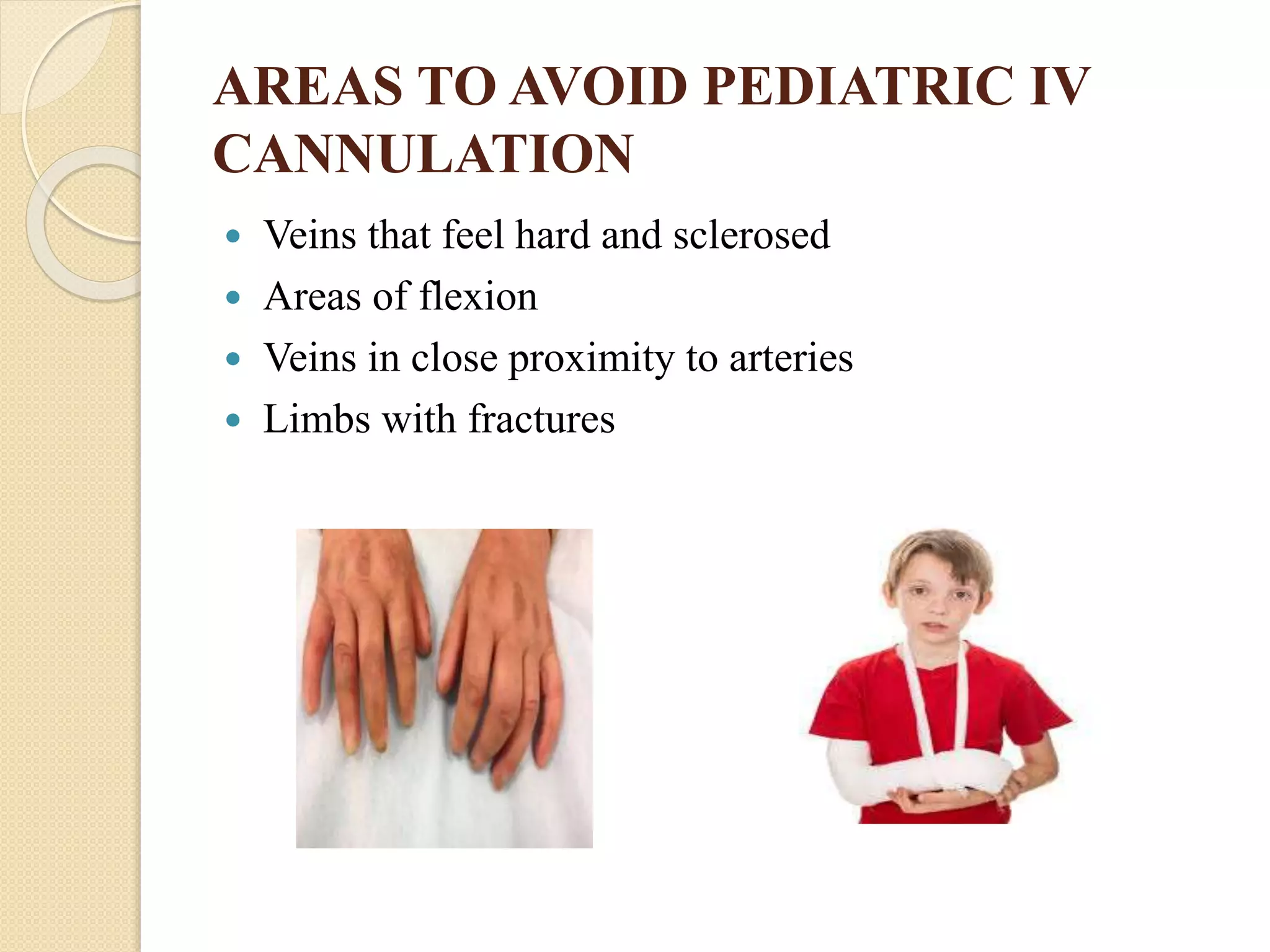 Pediatric intravenous cannulation | PPTX