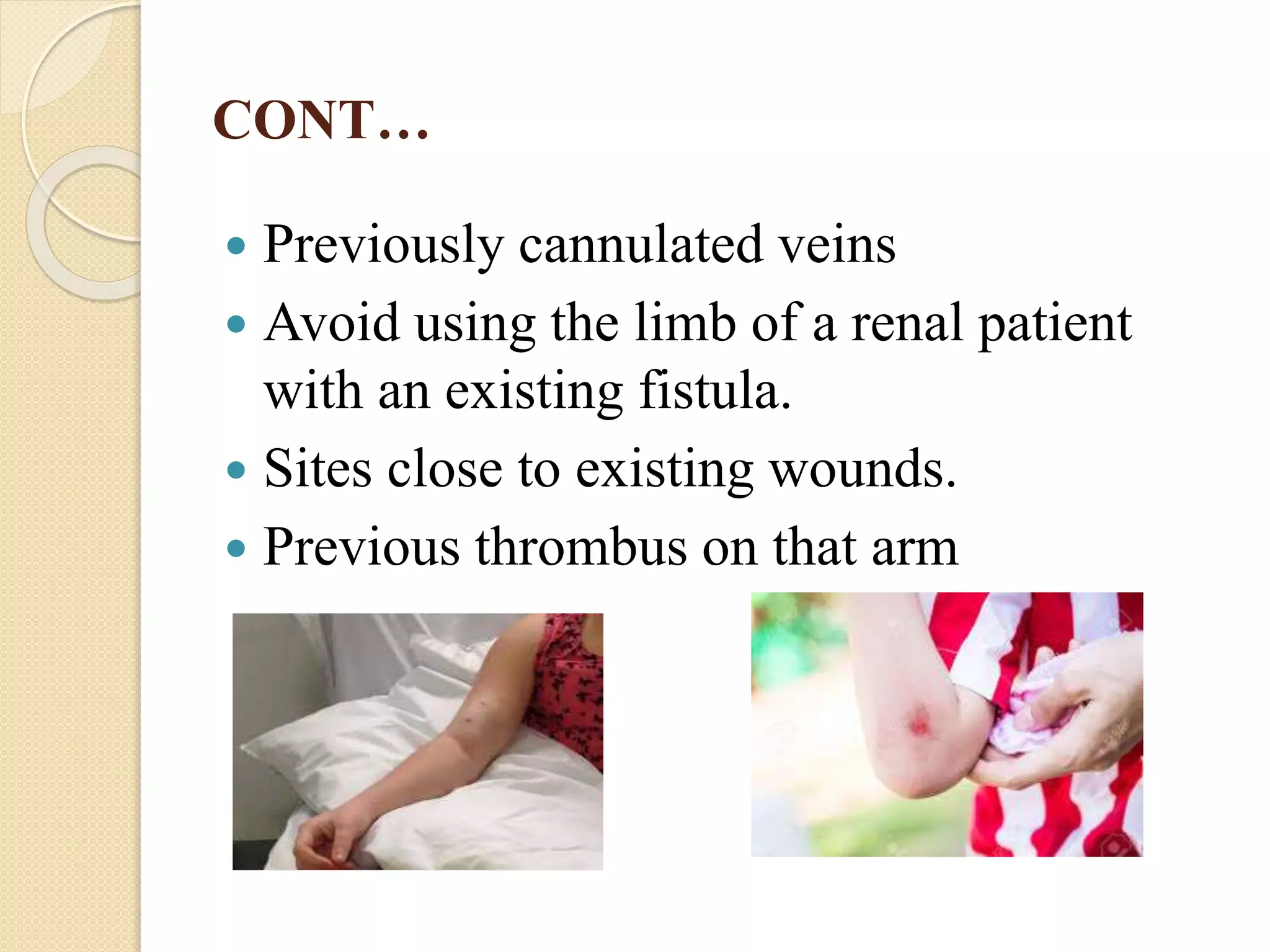 Pediatric intravenous cannulation | PPTX