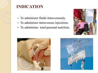 Pediatric intravenous cannulation | PPTX