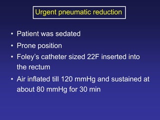 pediatric intssusception 2023.pptx