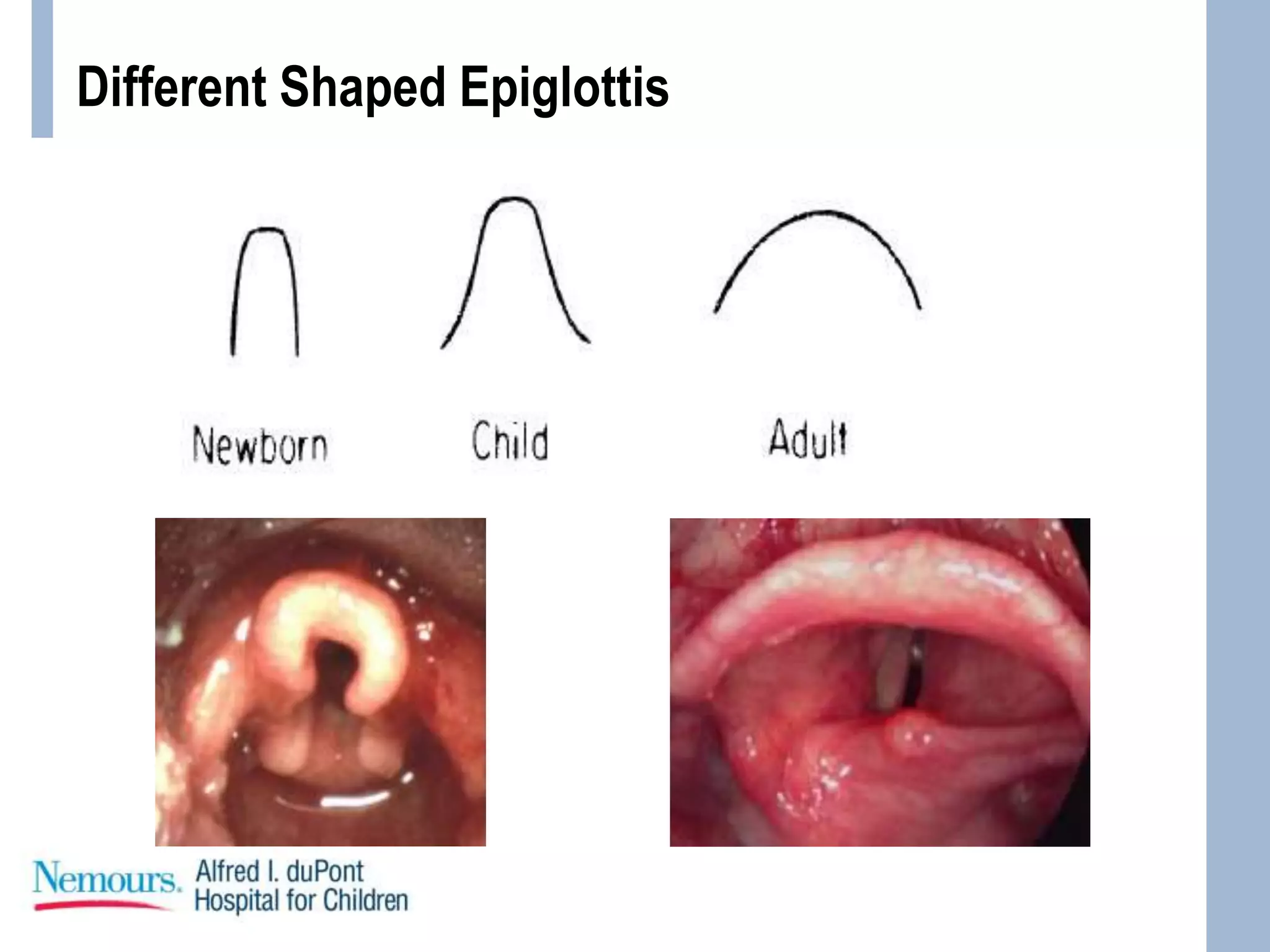 Pediatric intubation | PPTX