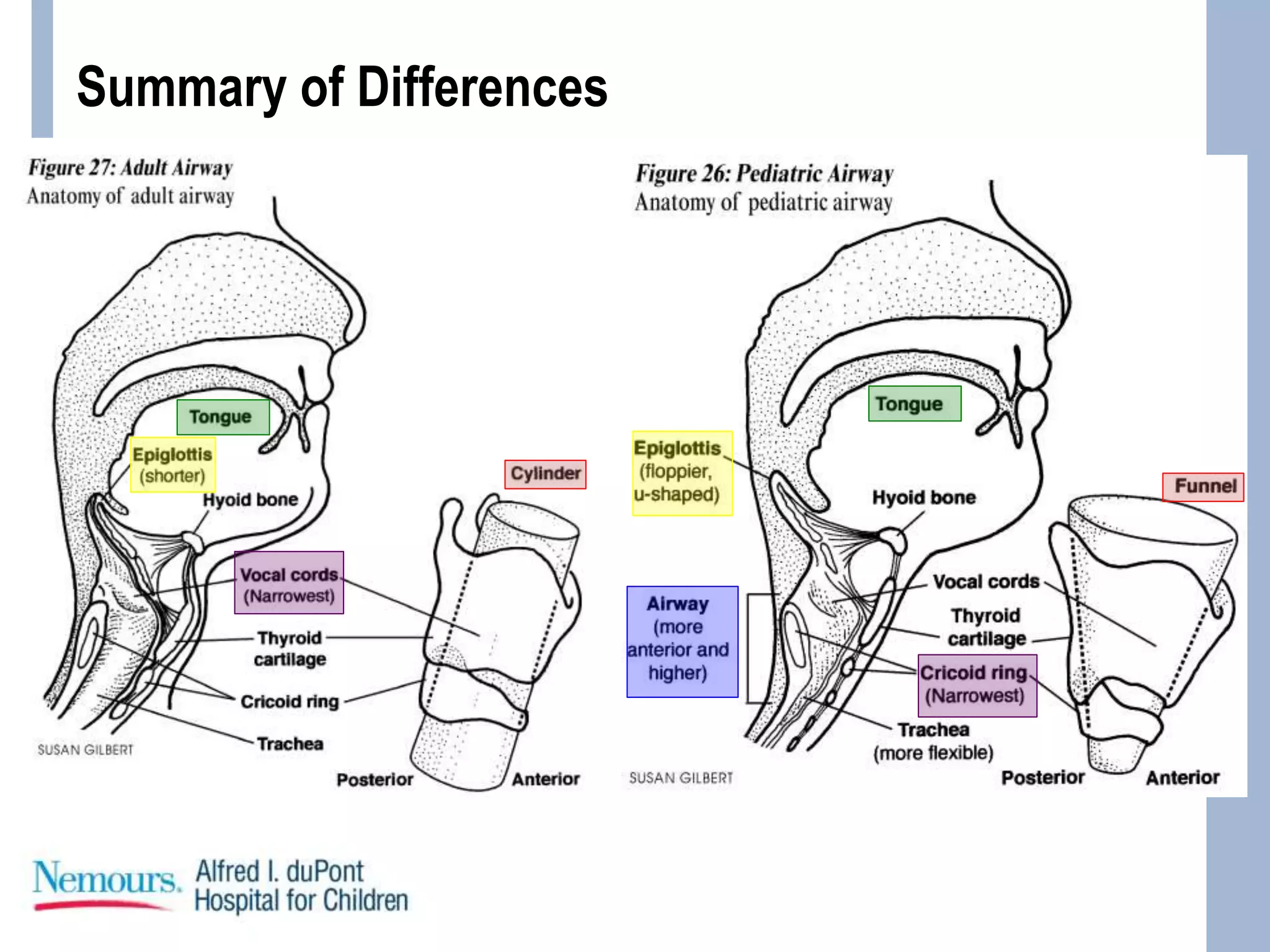 Pediatric intubation | PPTX