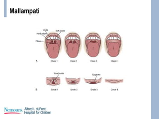 Pediatric intubation | PPTX