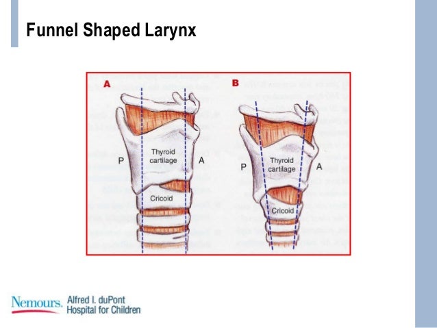 Pediatric intubation
