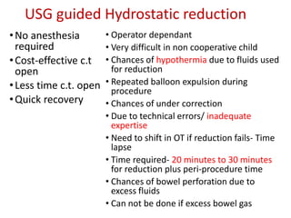 Pediatric Intussusception | PPTX