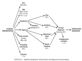 Pediatric Intussusception | PPTX