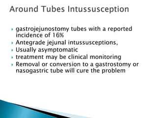 Pediatric intussusception final | PPTX