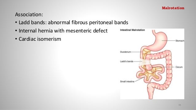 Imaging in Paediatric Intestinal Obstruction