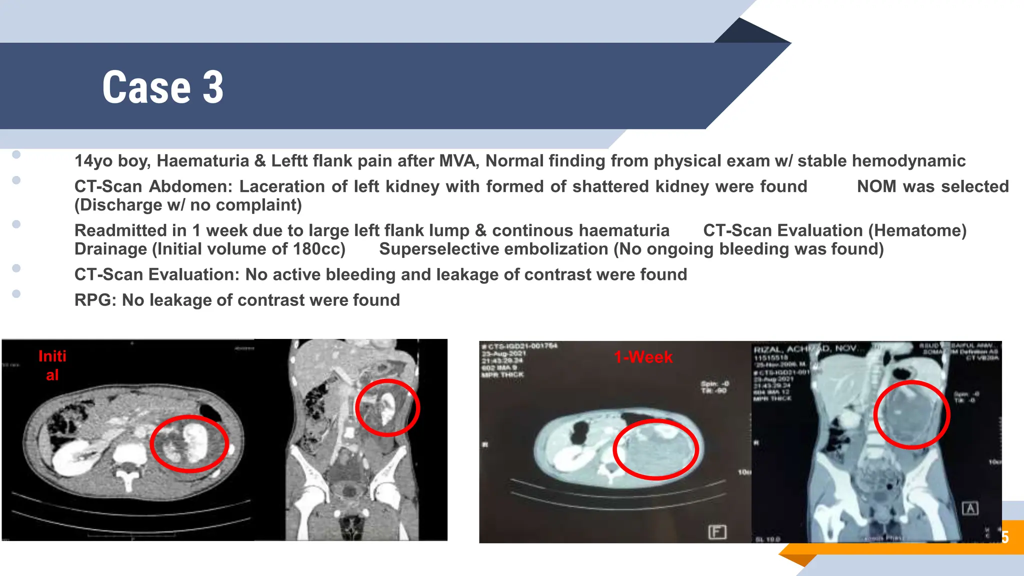 Pediatric Kidney Trauma.pptxxxxxxxxxxxxx | PPTX
