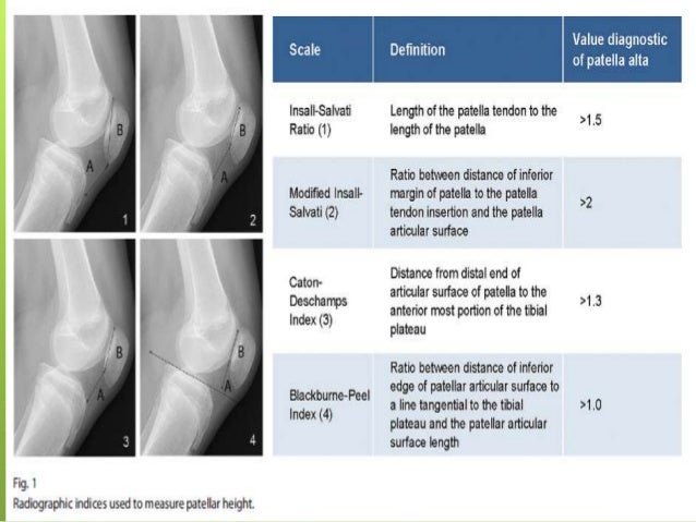 Pediatric knee copy