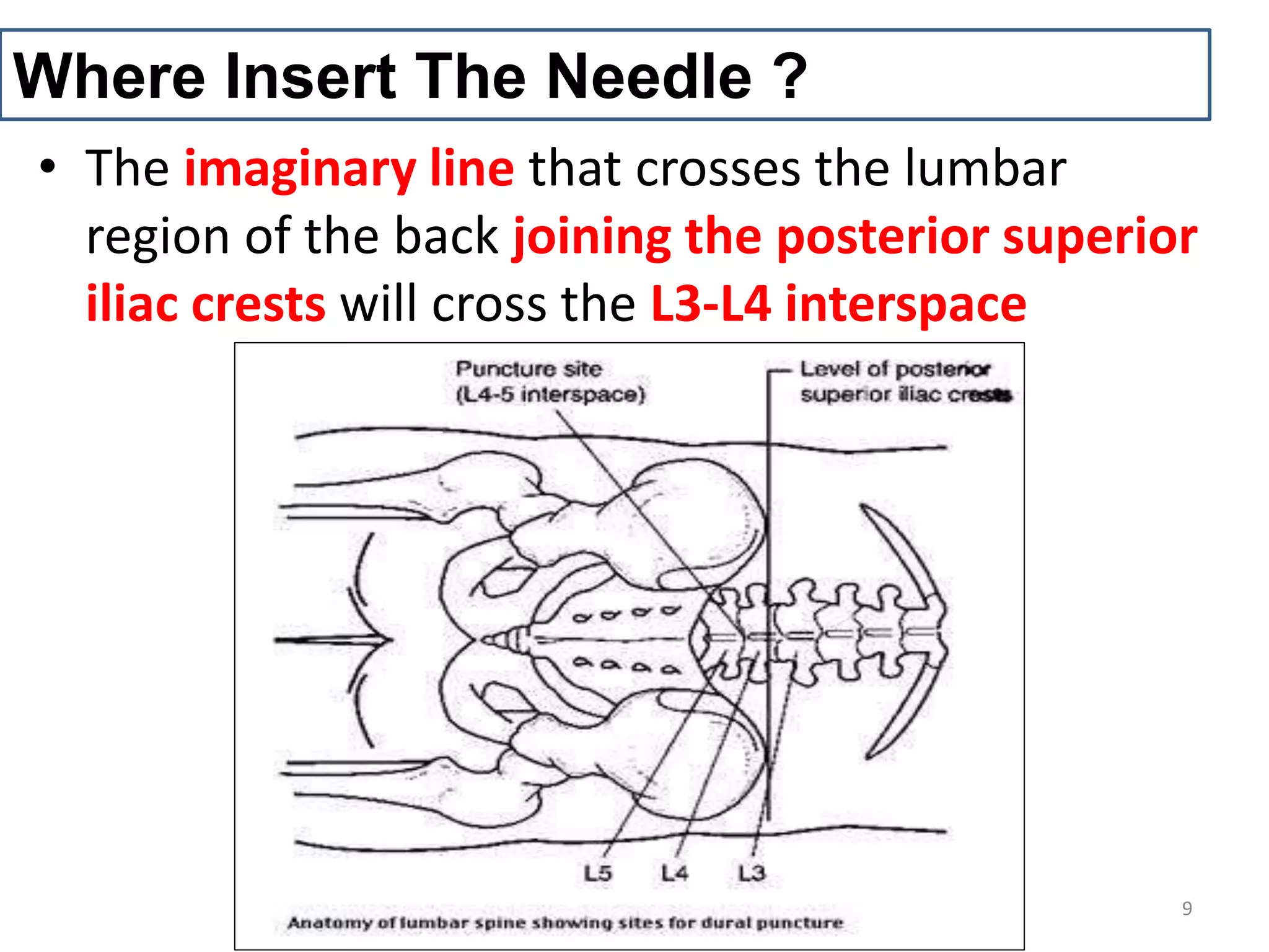 Pediatric lumbar puncture | PPTX