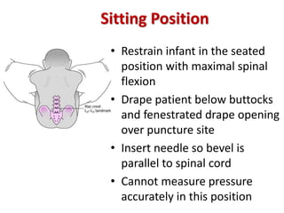 Pediatric lumbar puncture | PPTX