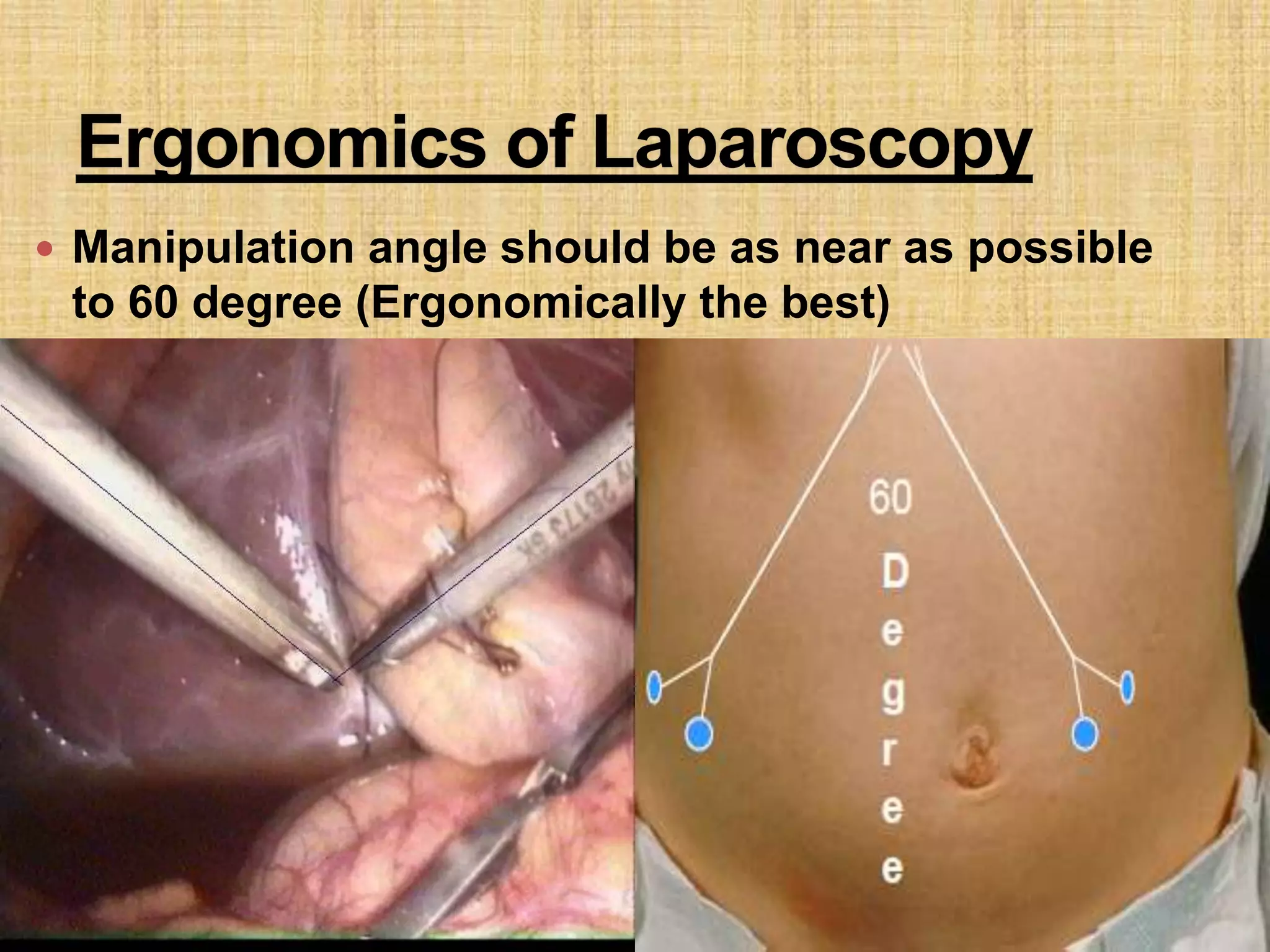 Pediatric laparoscopy | PPT