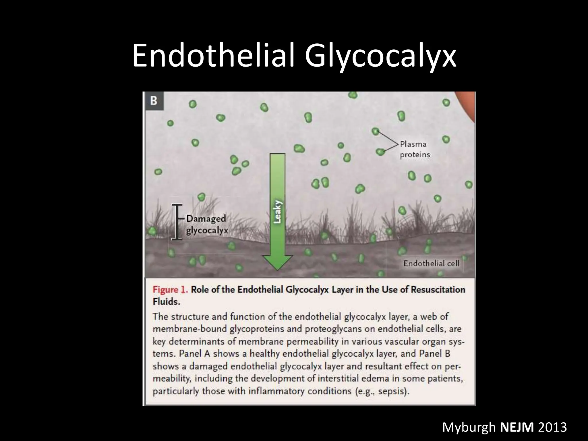 Pediatric Liver Transplantation – Fluid Management.pptx