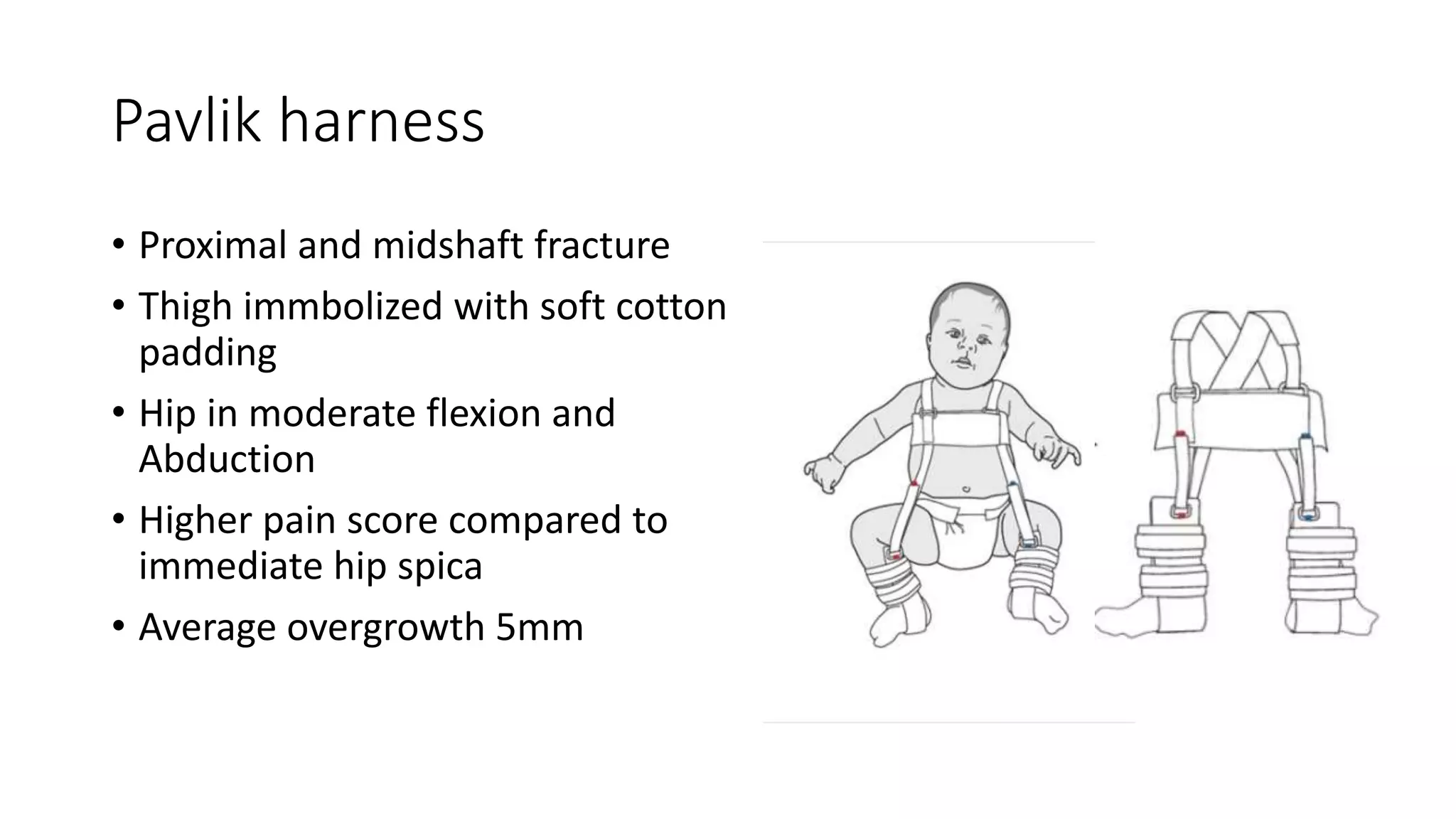 Pediatric Long Bone Fractures.pptx