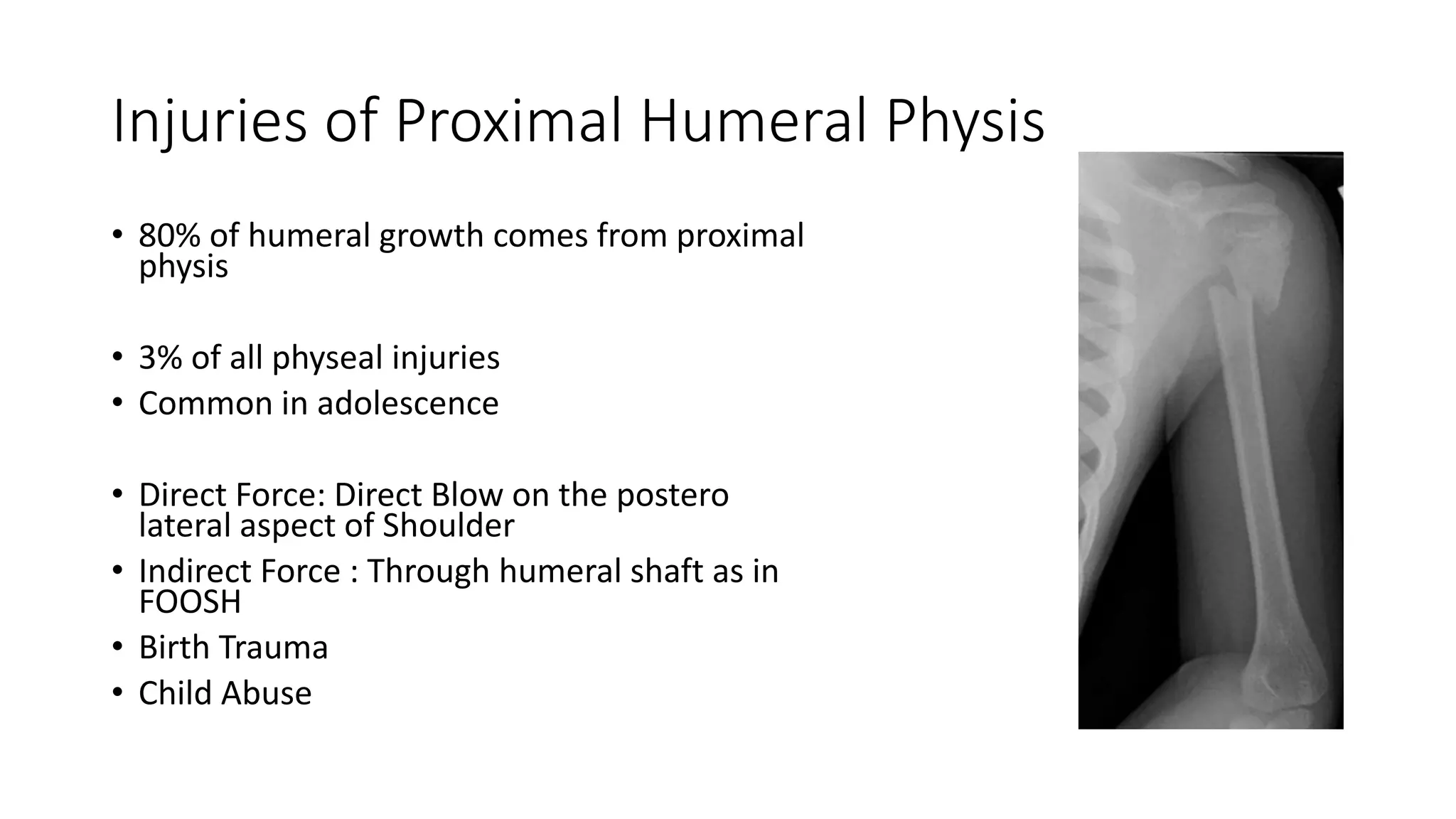 Pediatric Long Bone Fractures.pptx
