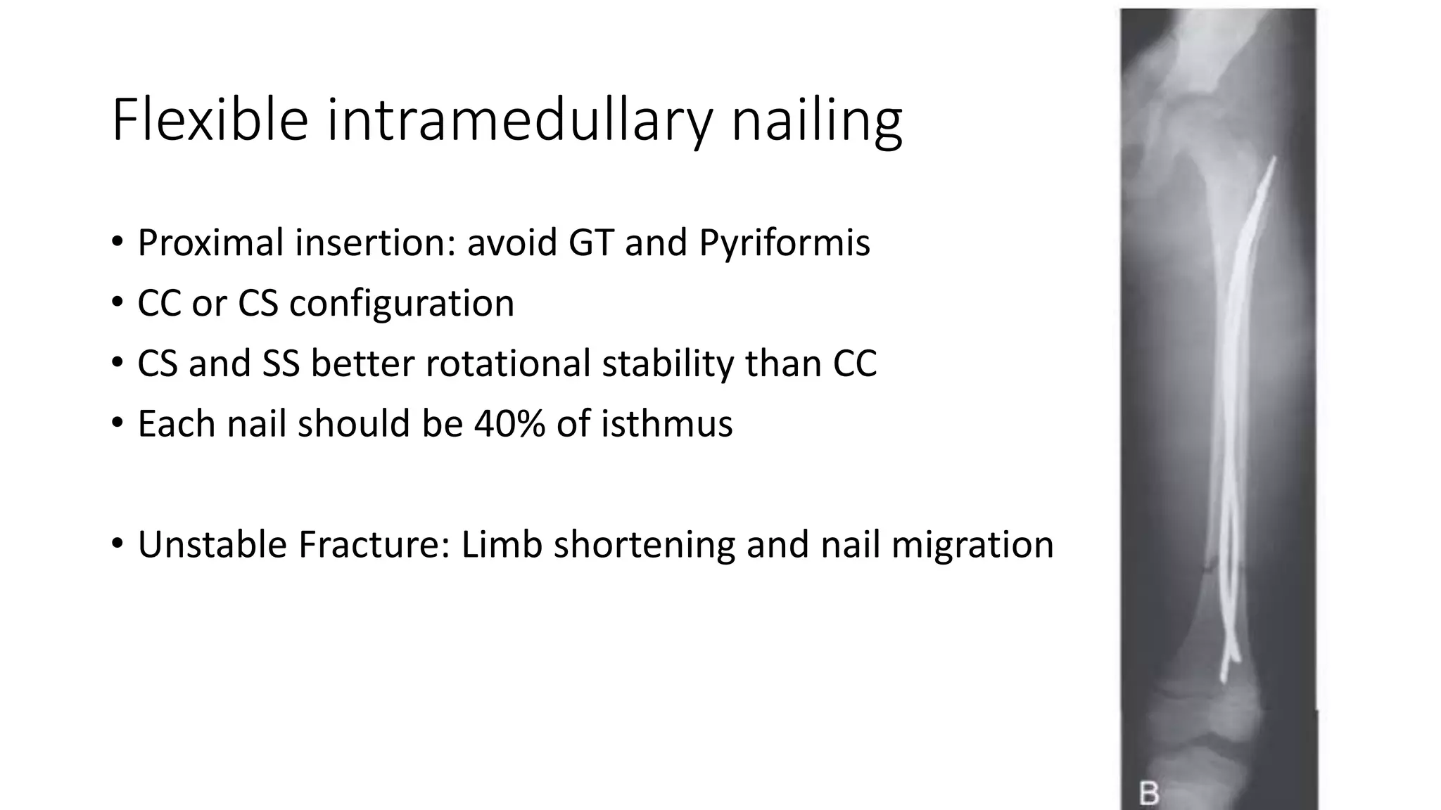 Pediatric Long Bone Fractures.pptx