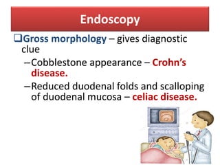 Pediatric malabsorption syndromes clinical presentation, malabsorption ...