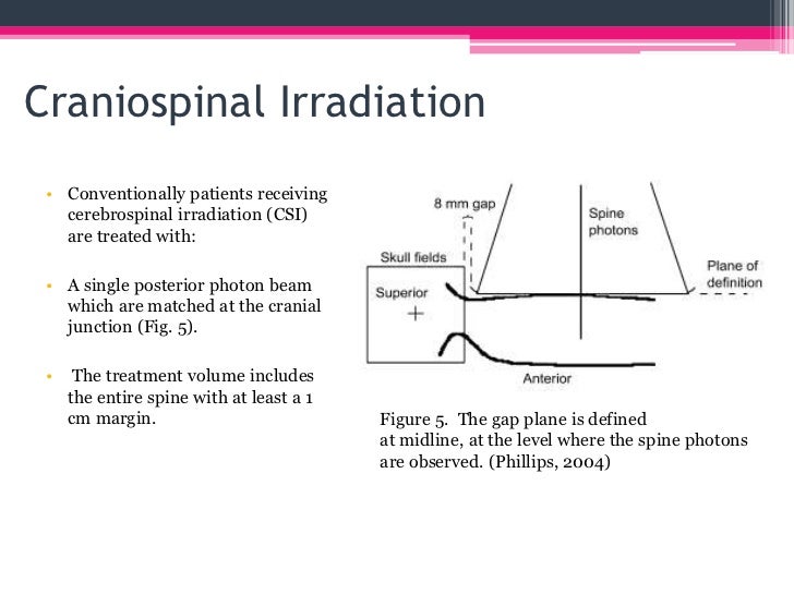Pediatric medulloblastoma
